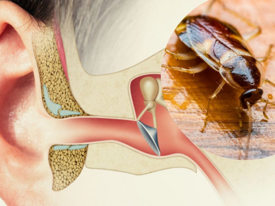 Guía práctica: Cómo sacar una chiripa del oído de manera segura
